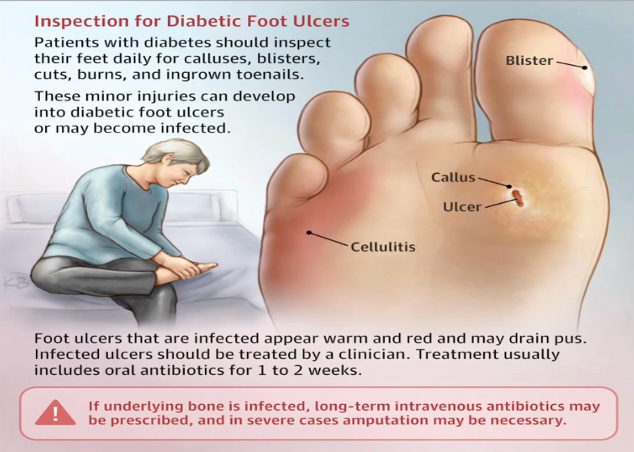 Beyond Blood Sugar: Navigating Skin Complications in Diabetes